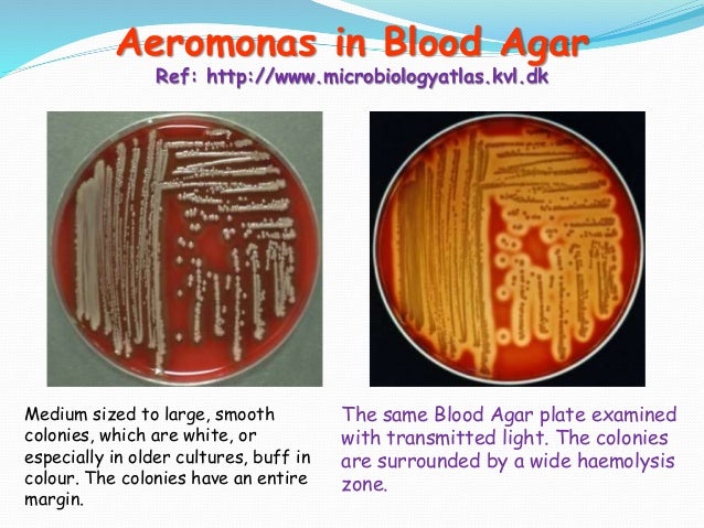 Aeromonas Postgraduate Seminar Maulana Azad Medical College Delhi