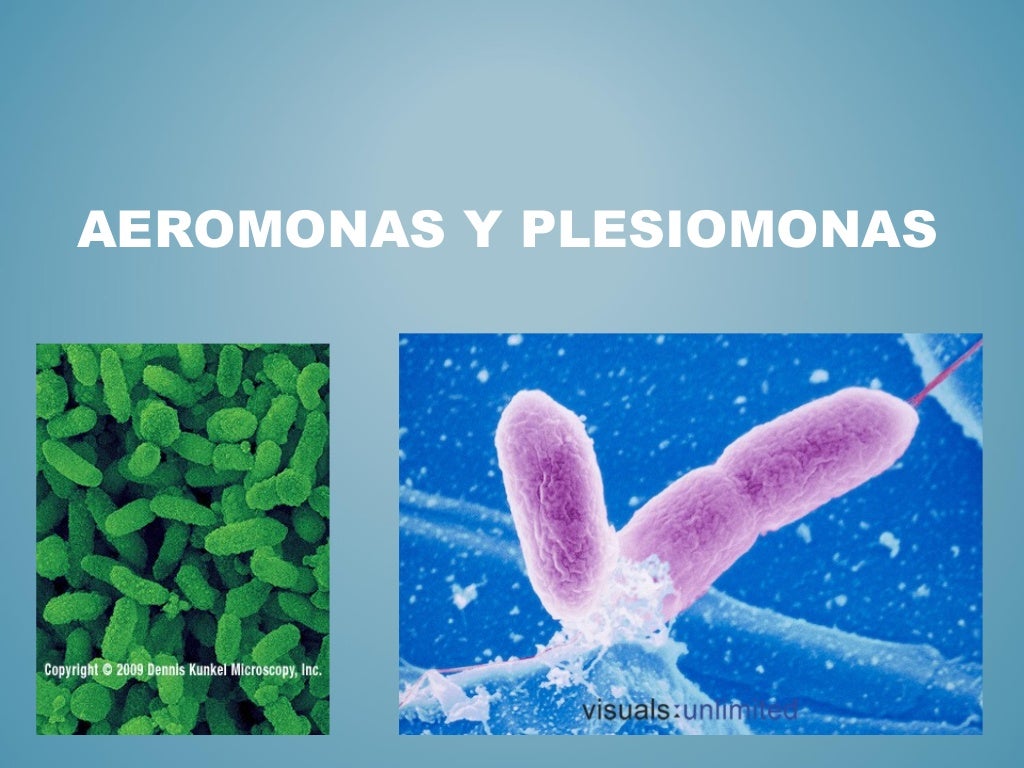 Aeromonas y plesiomonas
