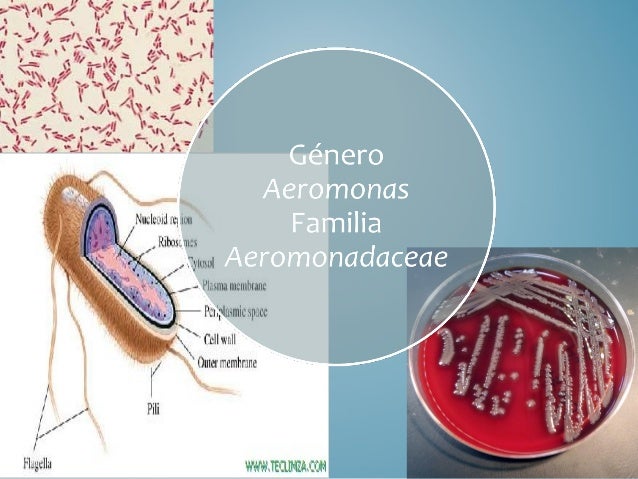 Aeromonas y plesiomonas