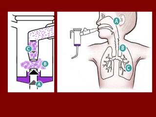 Aerosol therapy | PPT