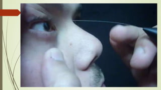 Aesthesiometer | PPTX