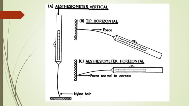 Aesthesiometer | PPTX