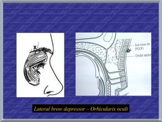 Aesthetic Anatomy Of The Forhead And Brow | PPT