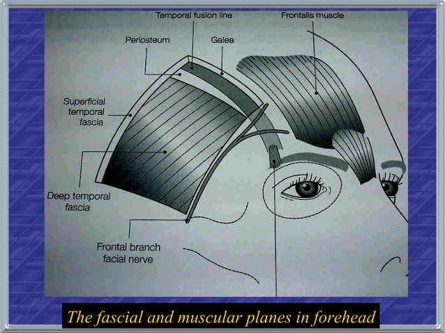 Aesthetic Anatomy Of The Forhead And Brow | PPT