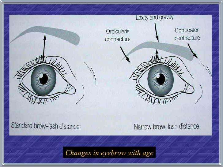 Aesthetic Anatomy Of The Forhead And Brow