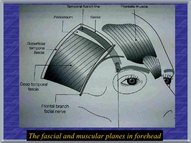 Aesthetic Anatomy Of The Forhead And Brow