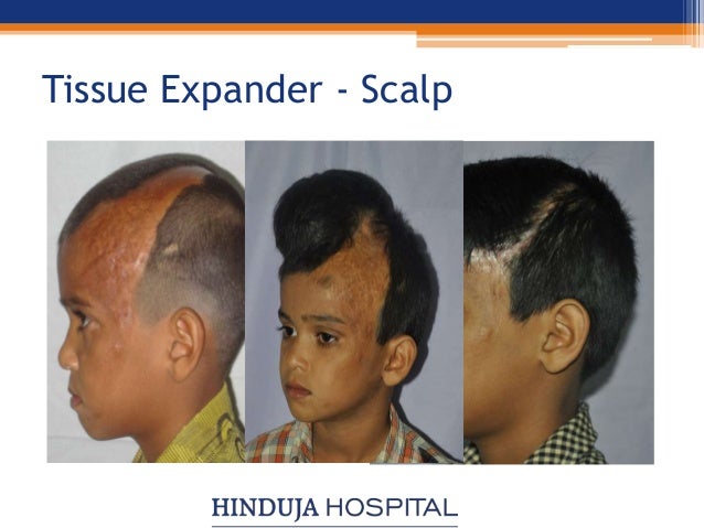 Hinduja Hospital Webinar on Aesthetic Plastic Surgery