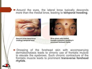 Aesthetics in oculoplastic | PPTX