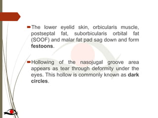 Aesthetics in oculoplastic | PPTX