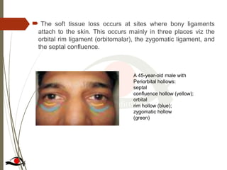 Aesthetics in oculoplastic | PPTX
