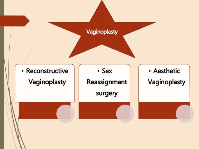 Aesthetic Vaginoplasty