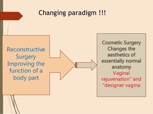 Aesthetic Vaginoplasty