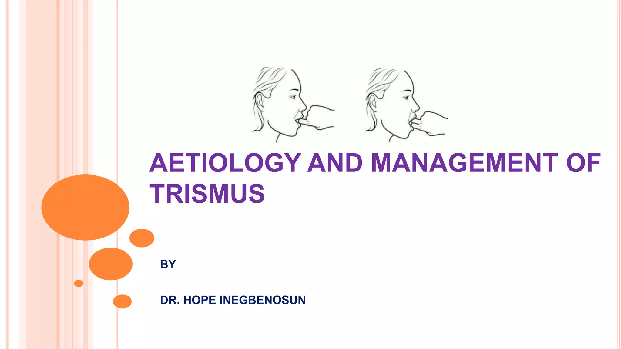 Aetiology and management of trismus | PPTX