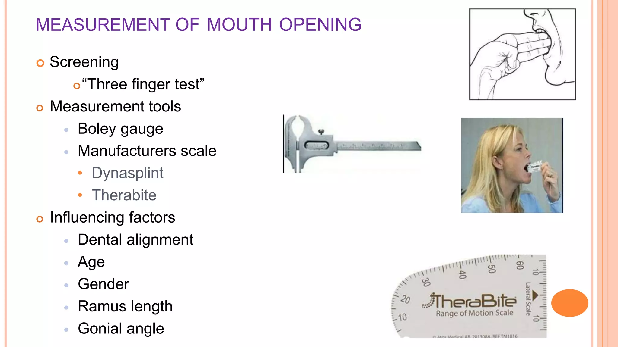 Aetiology and management of trismus | PPTX