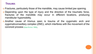 Aetiology and management of trismus | PPTX