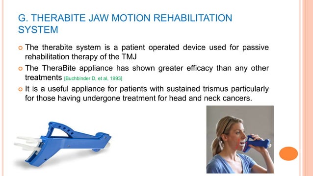 Aetiology and management of trismus | PPTX