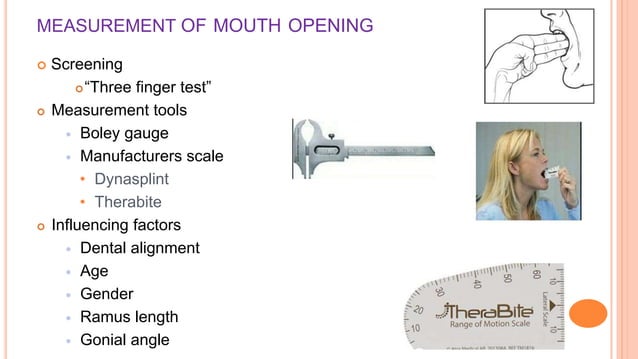 Aetiology and management of trismus | PPTX