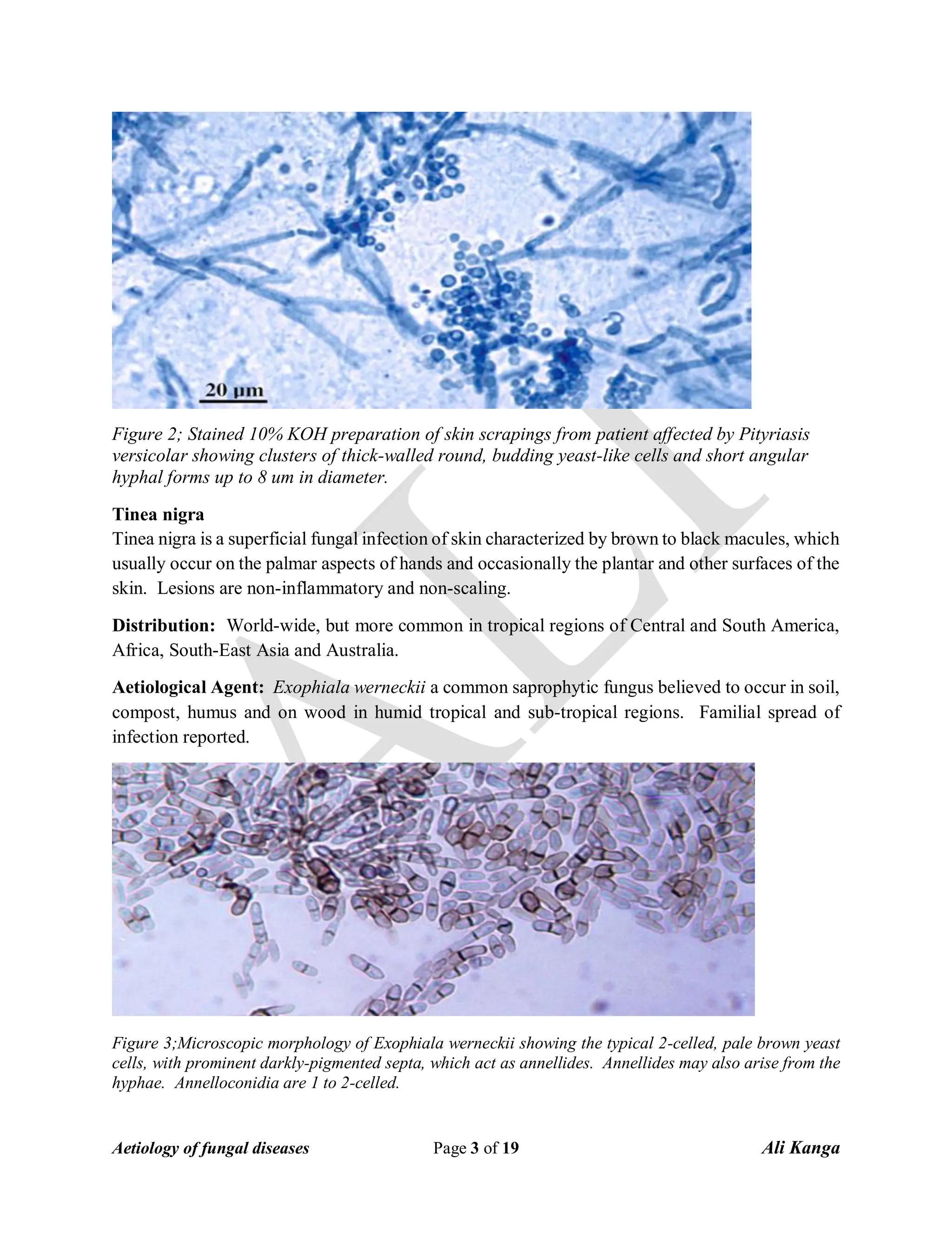 Power pointAetiology of Fungal diseases docx.pdf