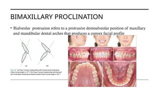 Aetiology of malocclusion CLASS I - MUNIRAH.pptx