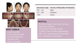 Aetiology of malocclusion CLASS I - MUNIRAH.pptx