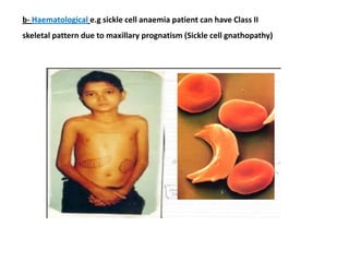 Etiology of Malocclusion_ Genral Factors Dr.Nabil Al-Zubair | PDF