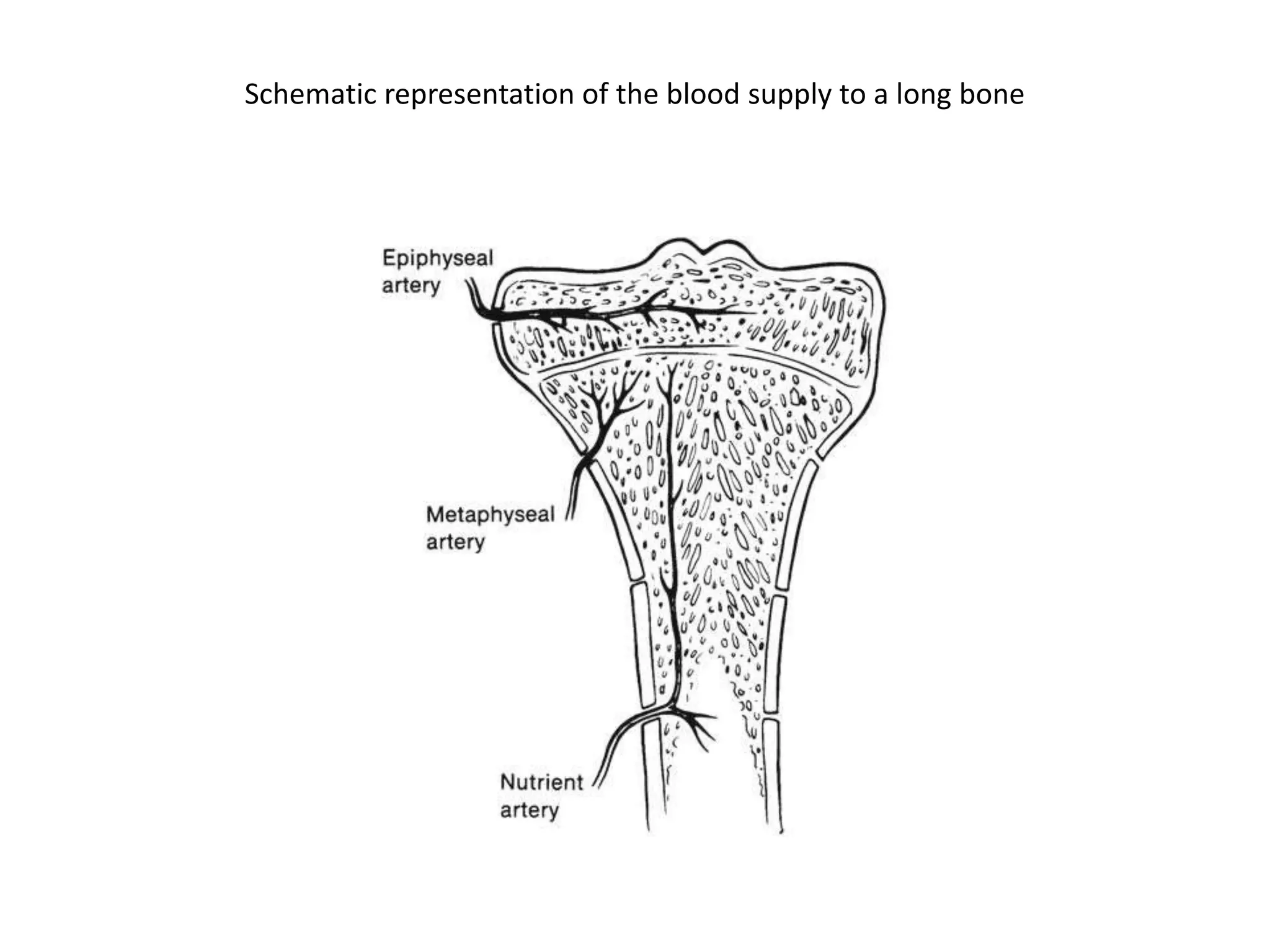 Aetiology, pathology and management of osteomyelitis | PPTX