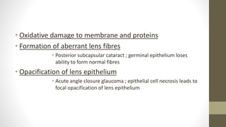 Aetiopathogenesis of cataract | PPTX