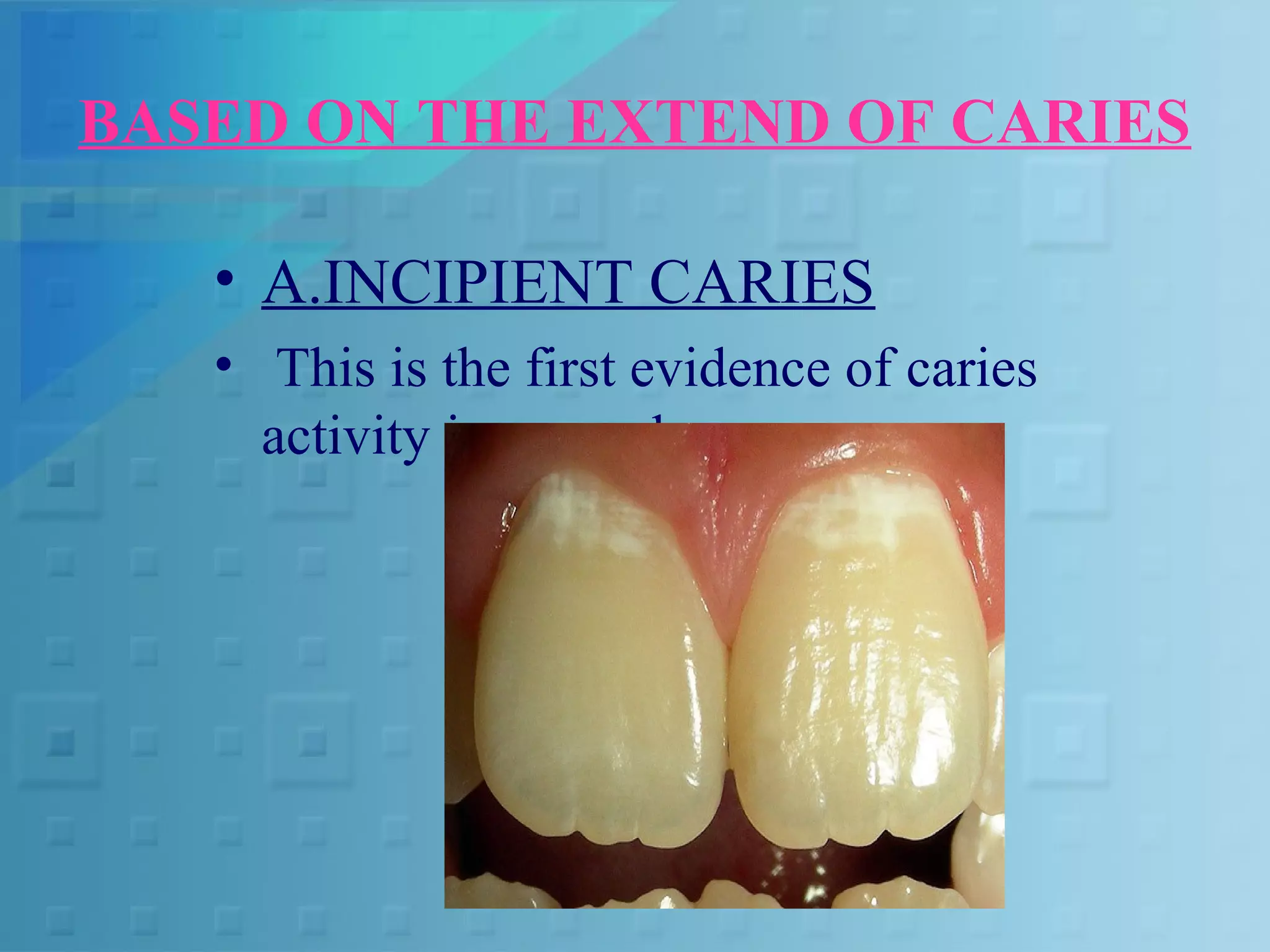 Aetiopathology & classification of caries | PPT