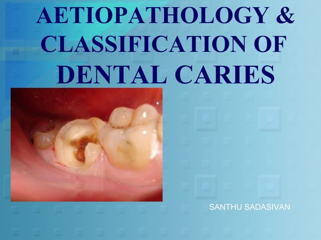 Aetiopathology & classification of caries | PPT
