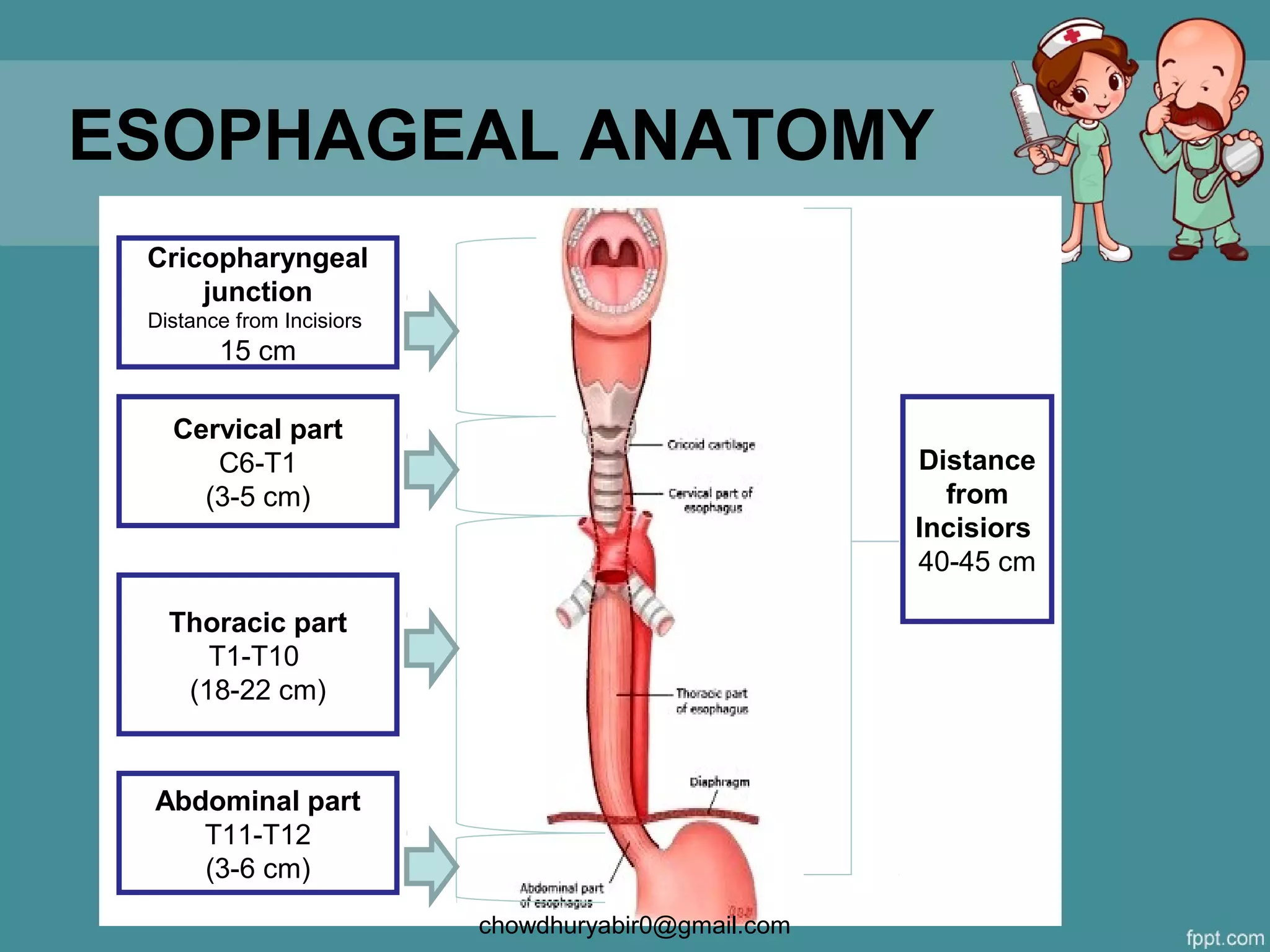 Esophageal Perforation | PPT