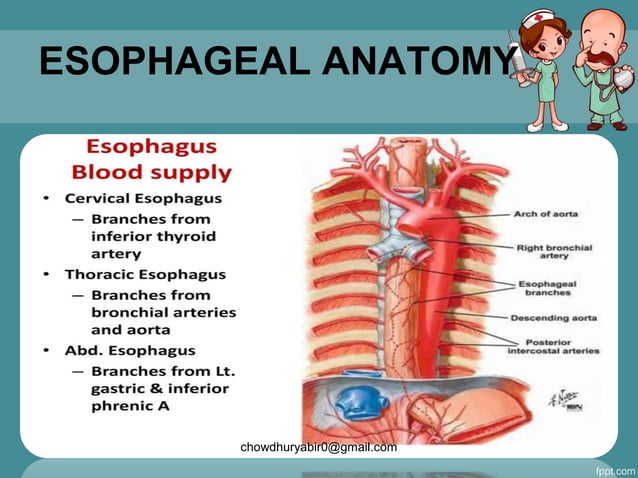 Esophageal Perforation | PPT