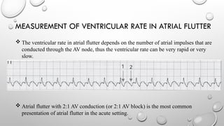 Atrial fibrillation & atrial flutter.pptx