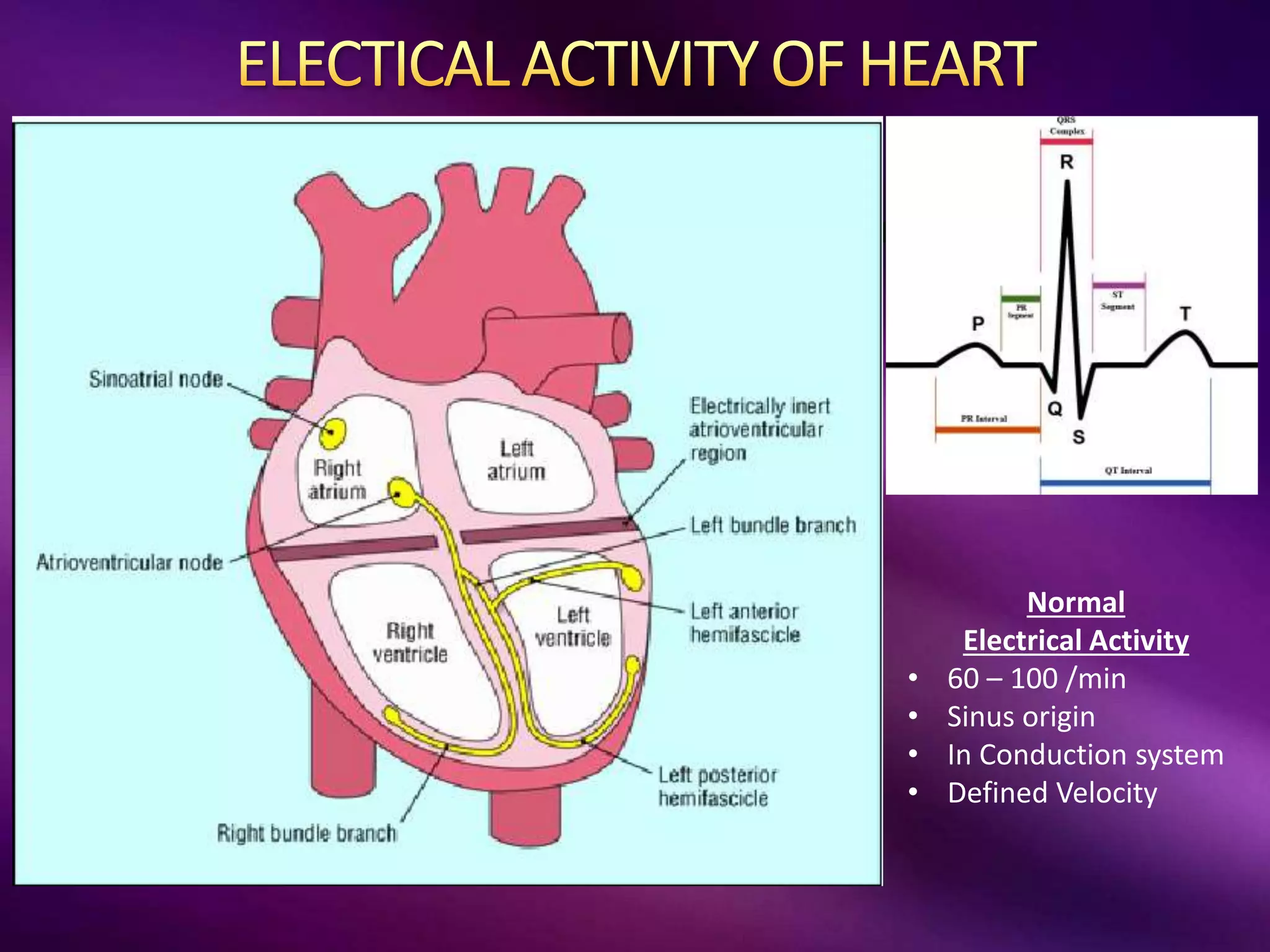 ATRIAL FIBRILLATION | PPTX