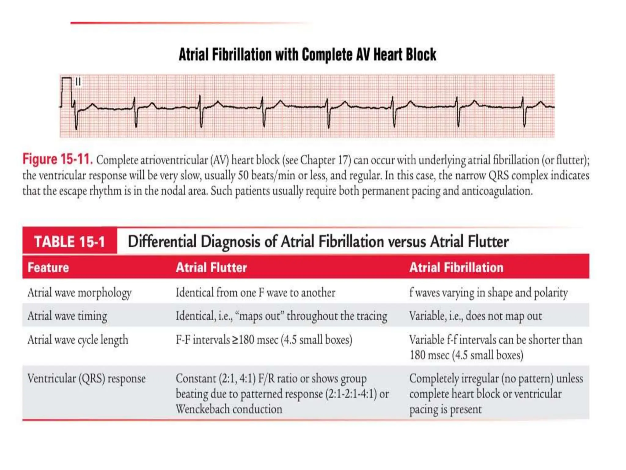 atrial fib and atrial flutter .pptx