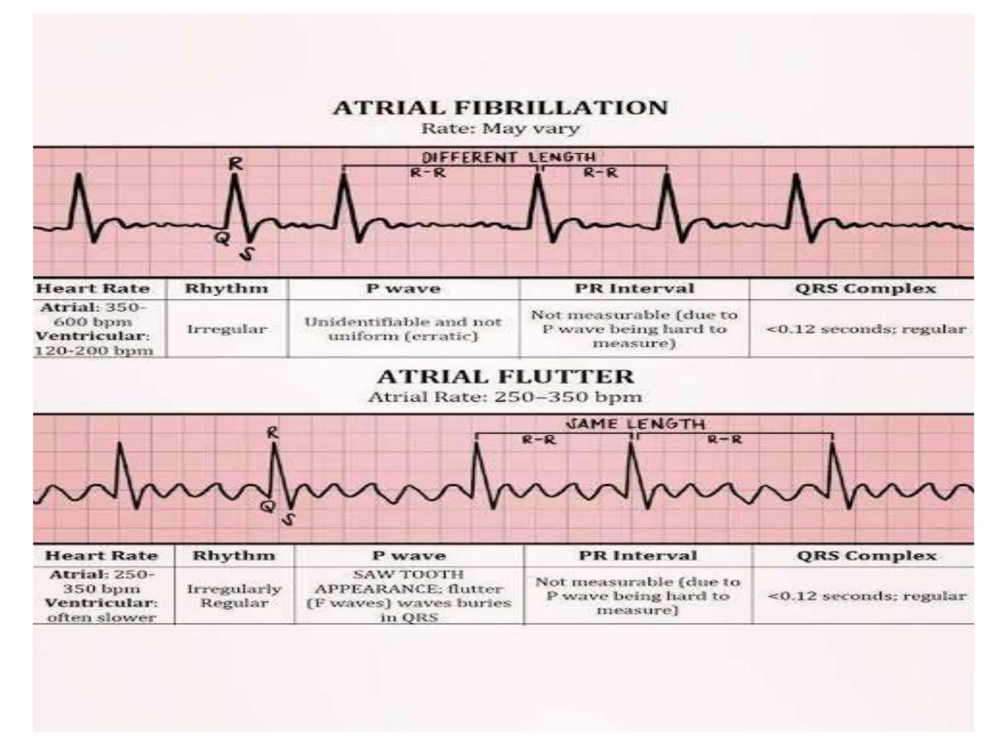 atrial fib and atrial flutter .pptx