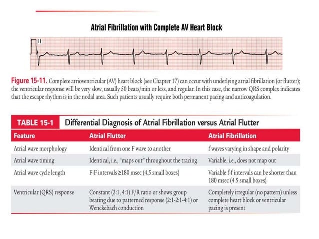 atrial fib and atrial flutter .pptx