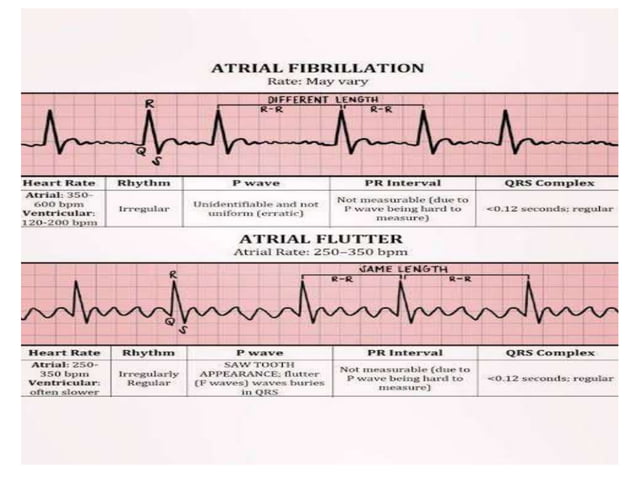 atrial fib and atrial flutter .pptx