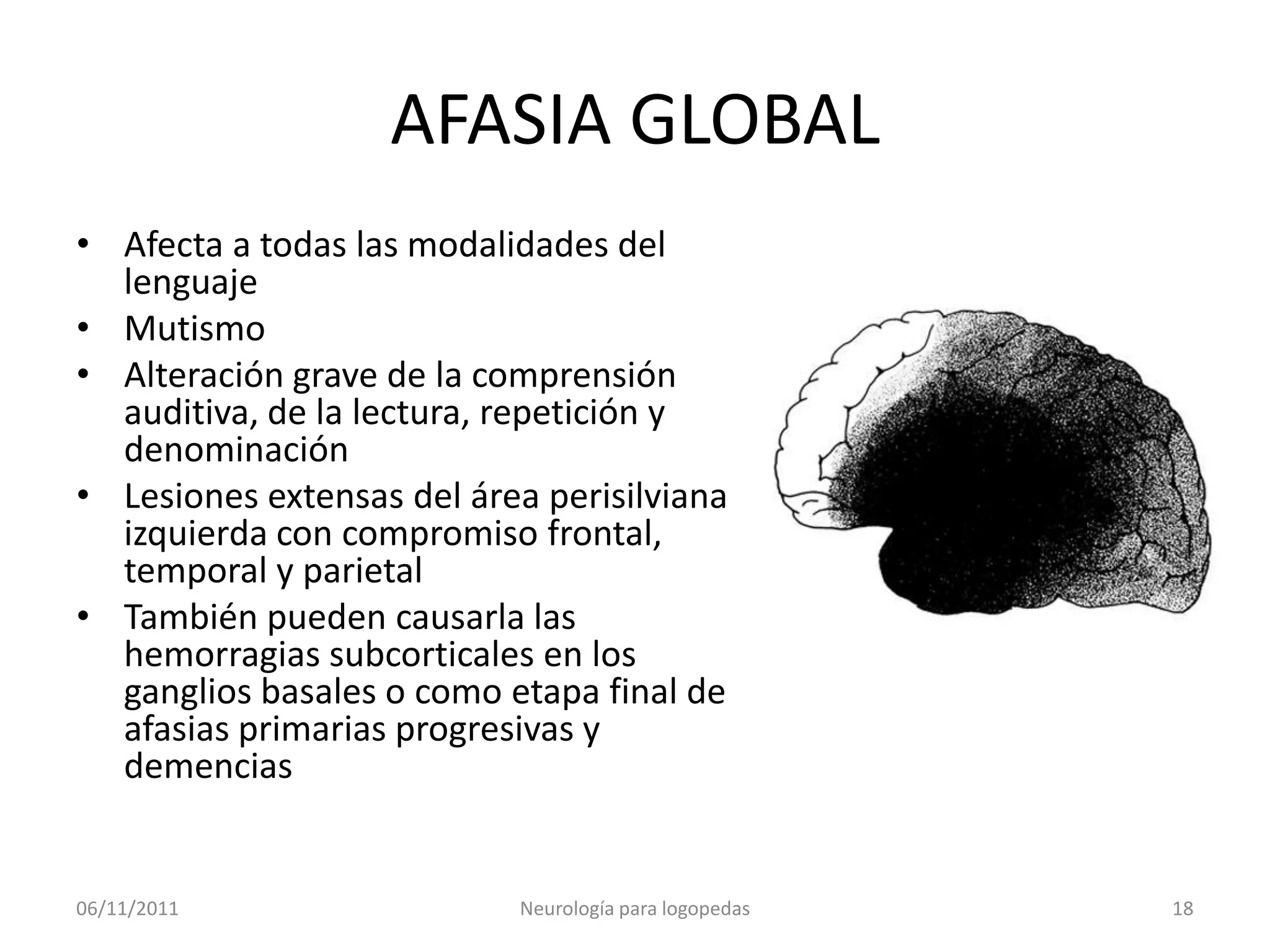 Afasia, alexia, agrafia, apraxia, disartria | PPTX | Brain and Nervous ...