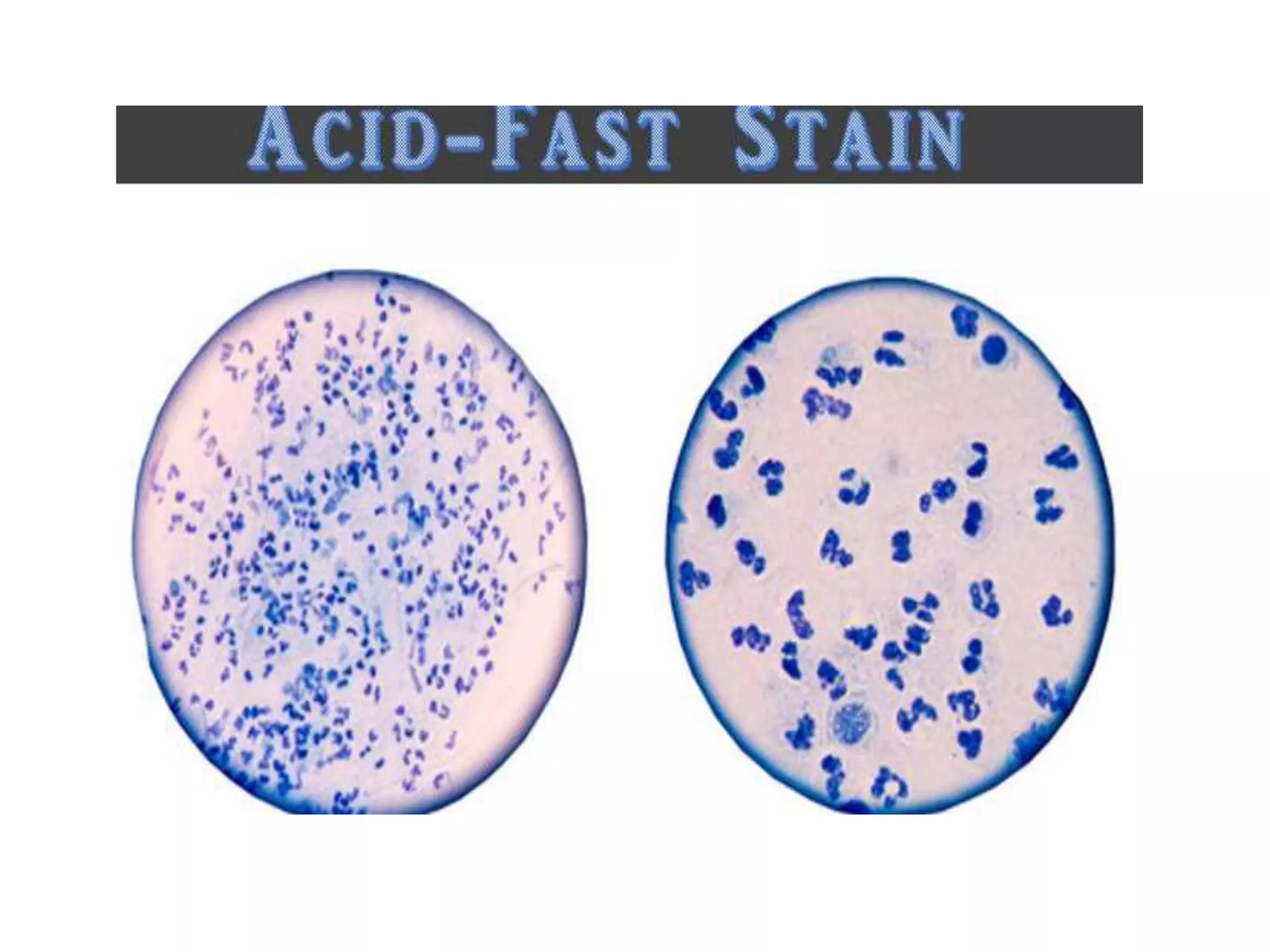 AFB (Acid-Fast Bacilli) smear staining.pptx