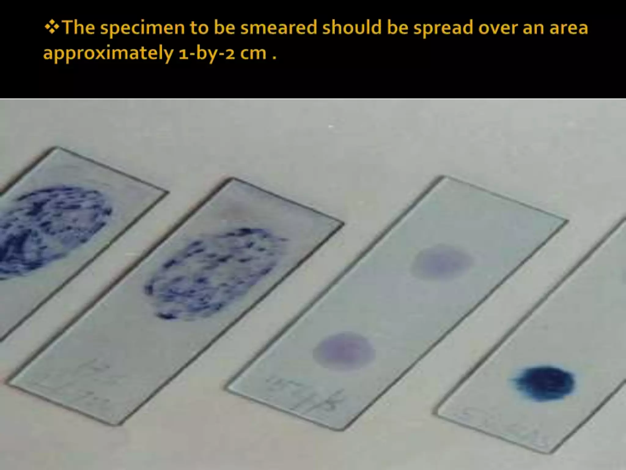 AFB (Acid-Fast Bacilli) smear staining.pptx