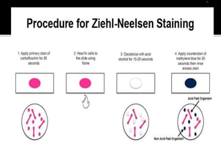 AFB (Acid-Fast Bacilli) smear staining.pptx