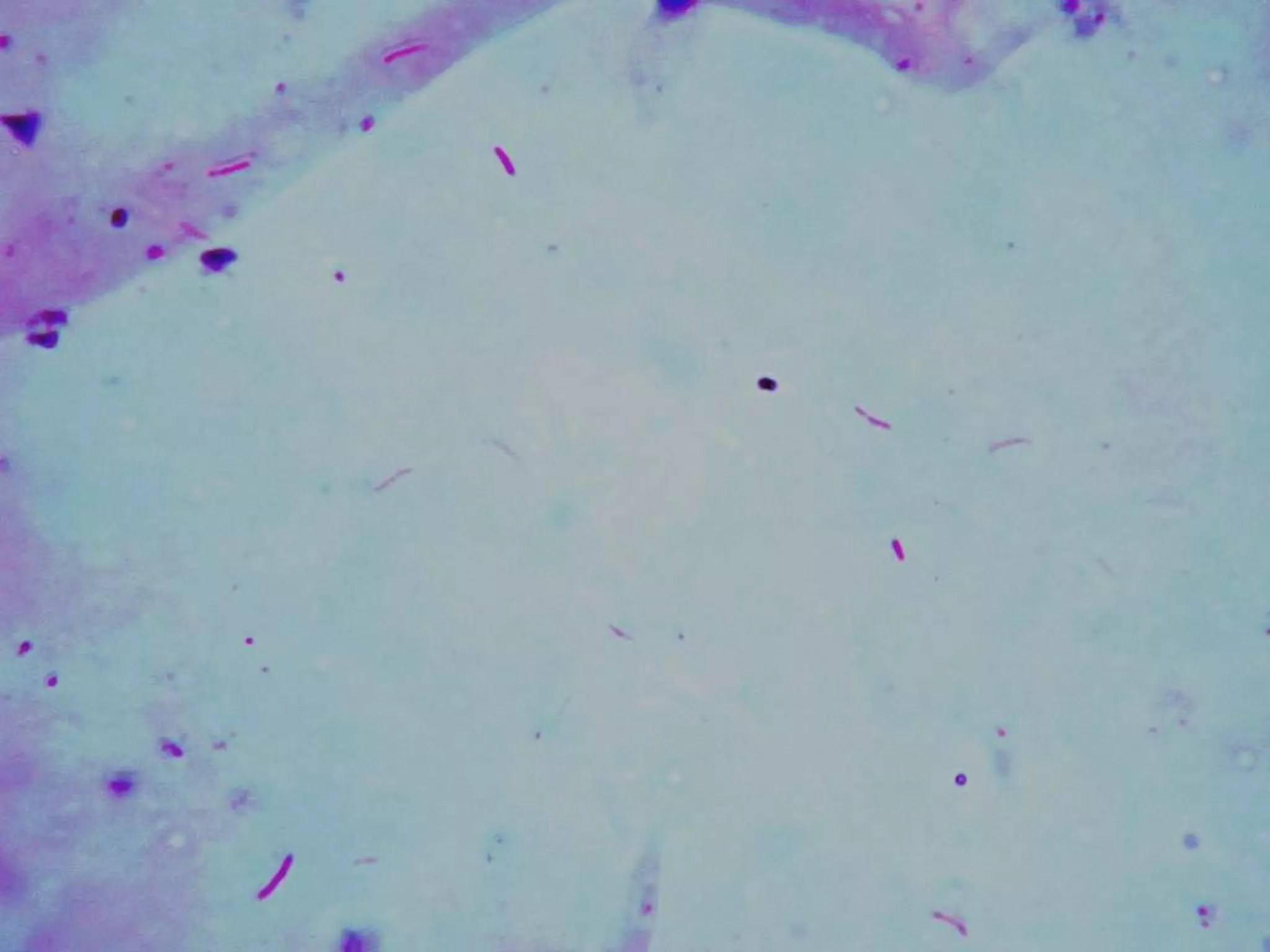 Afb microscopy and quality assurance copy | PPT