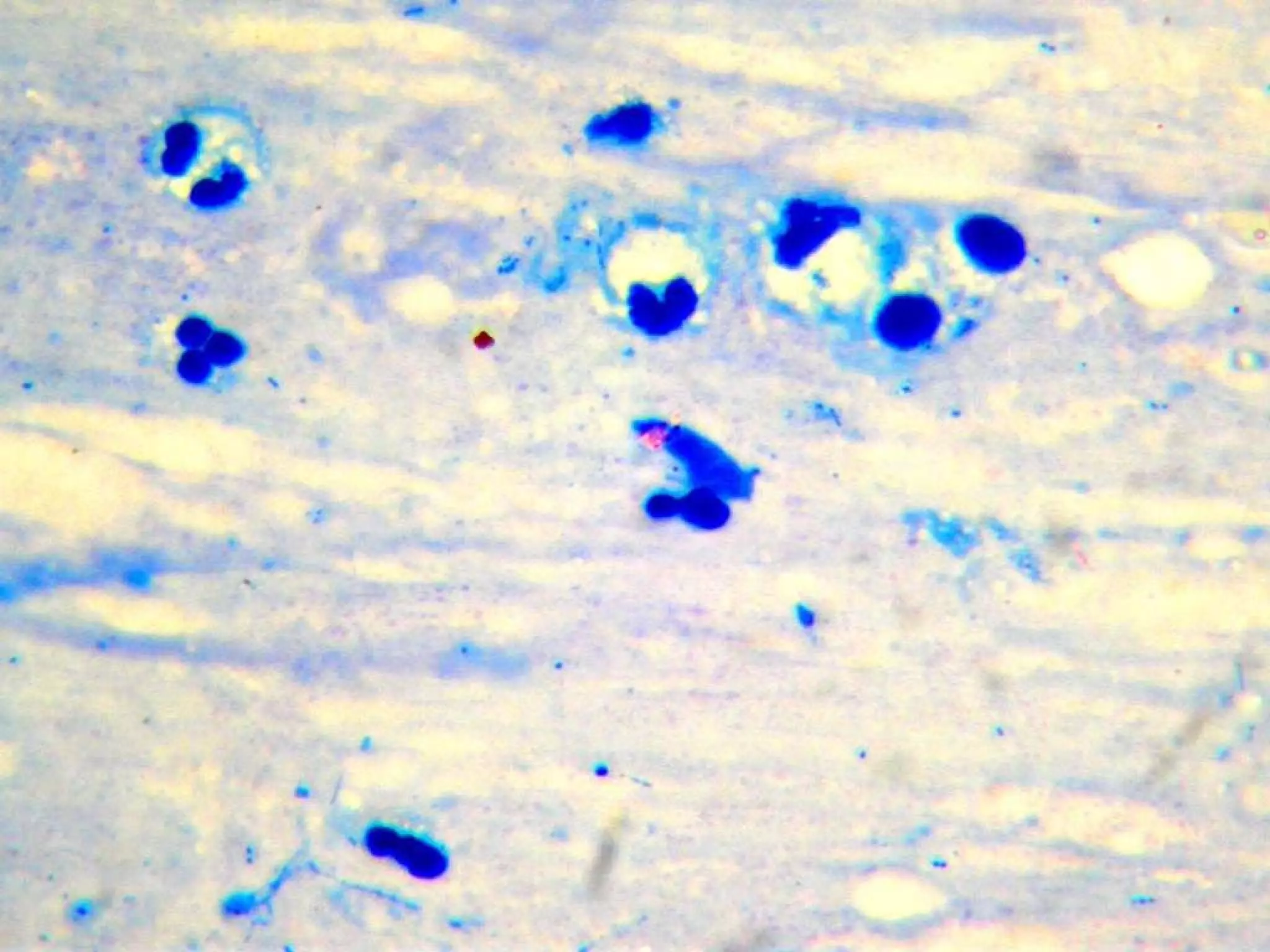 Afb microscopy and quality assurance copy | PPT