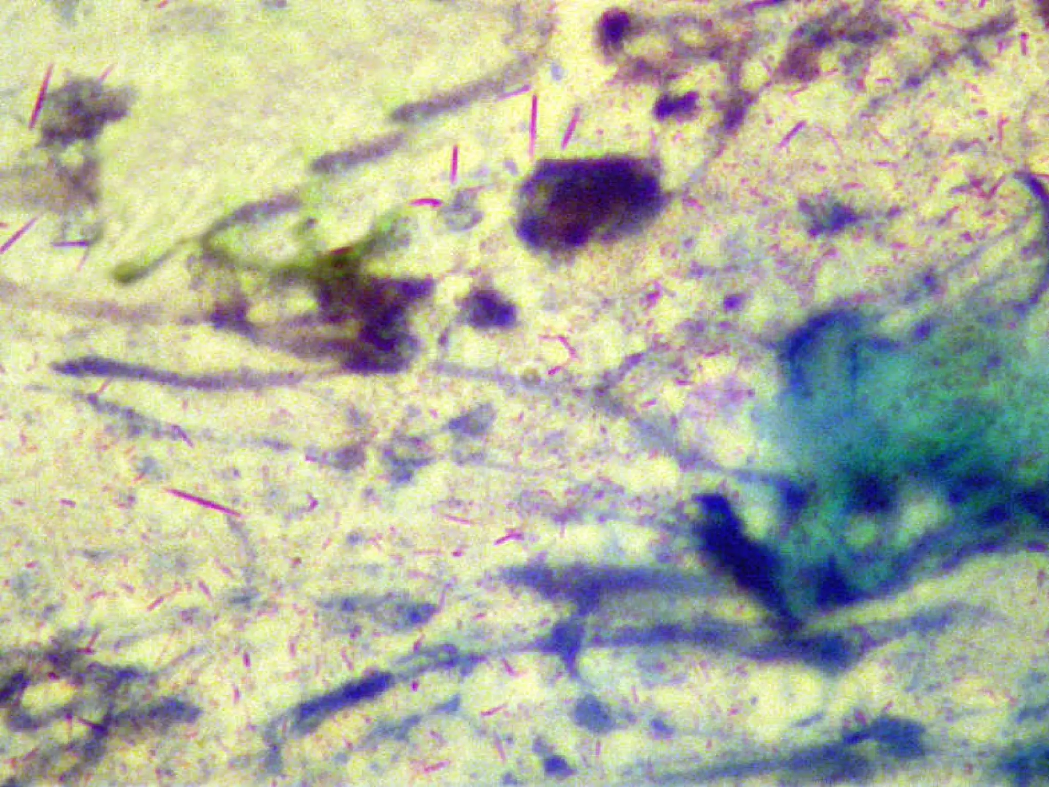 Afb microscopy and quality assurance copy | PPT