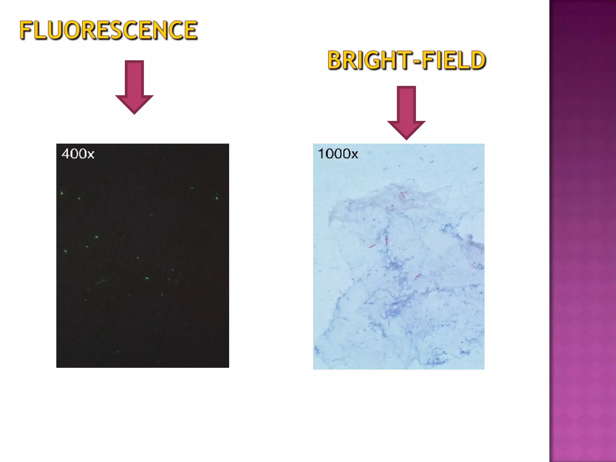 Afb microscopy and quality assurance copy | PPT