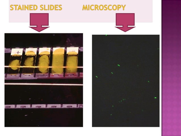 Afb microscopy and quality assurance copy | PPT