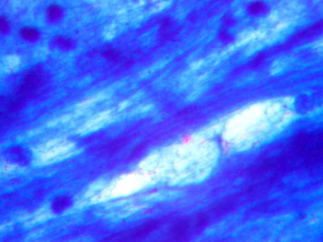 Afb microscopy and quality assurance copy | PPT