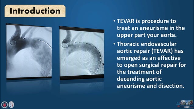 AFCC Implantation of Fenestrated TEVAR-converted.pdf