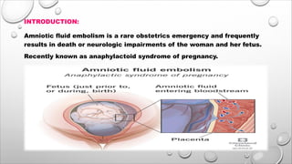 (AFE) anaphylactoid syndrome of pregnanvy.pdf