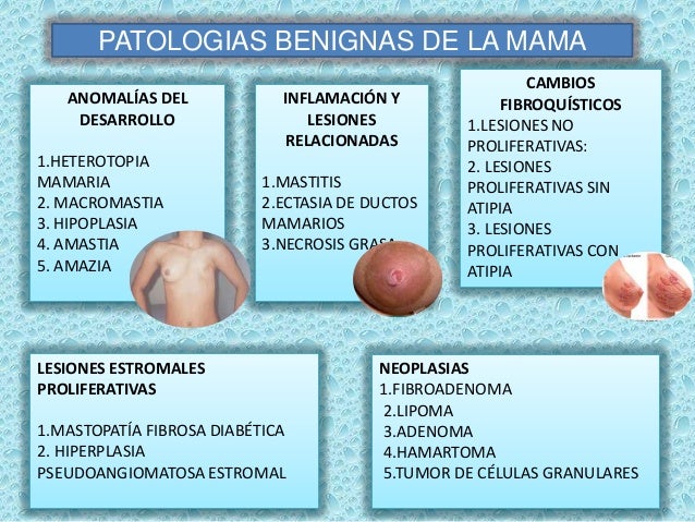 Afecciones mas frecuentes de las glándulas mamarias.